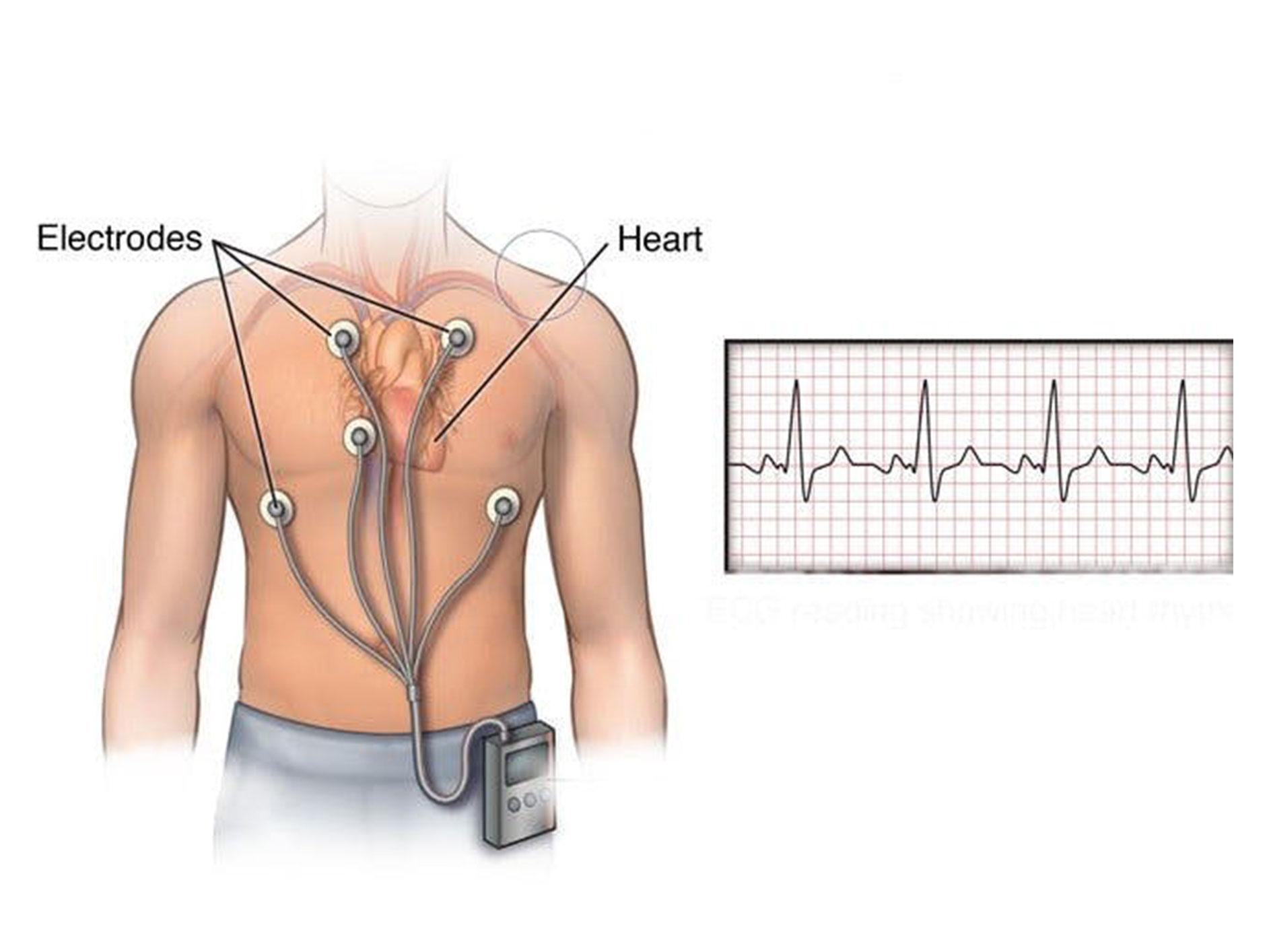 Dr. Nikhil Motiramani – Best Cardiologist In Raipur